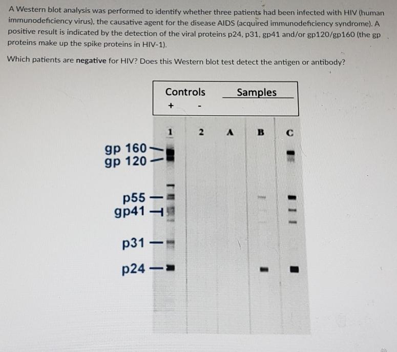 Solved A Western blot analysis was performed to identify | Chegg.com