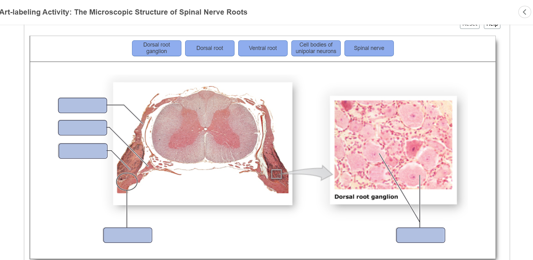 Solved Art-labeling Activity: Microscopic Structure of the | Chegg.com