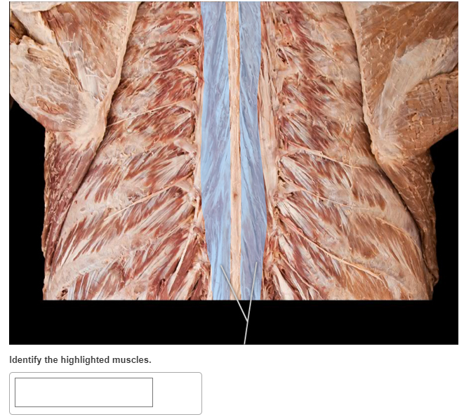 Solved Identify the highlighted cranial nerve by name only. | Chegg.com