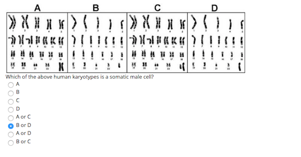 Solved Which of the above human karyotype is a somatic male | Chegg.com