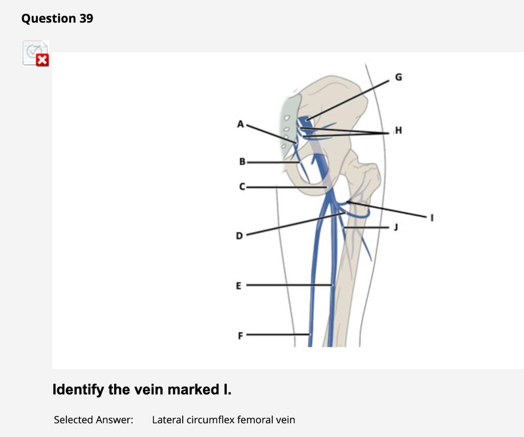 Solved Identify the vein marked K. This diagram is showing a | Chegg.com