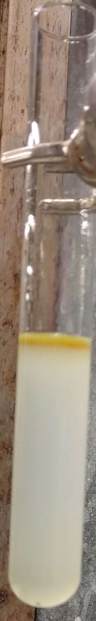 Solved In Chem lab, we performed an Iodoform test and I'm | Chegg.com