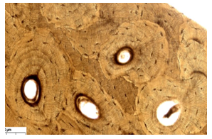 Solved Dense/Compact bone (bone-dry ground) screenshot. | Chegg.com