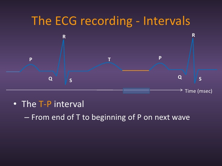 Solved What is the effect of exercise on T-P interval and | Chegg.com