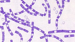 Solved If you Gram-stain spore-forming bacteria, you will | Chegg.com