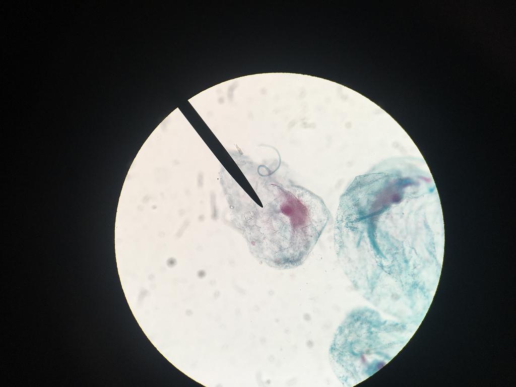 Solved Paramecium Ulothrix Claviceps purpurea | Chegg.com