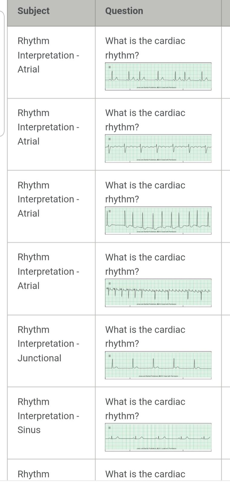 Solved Please interpret the following rhythms | Chegg.com