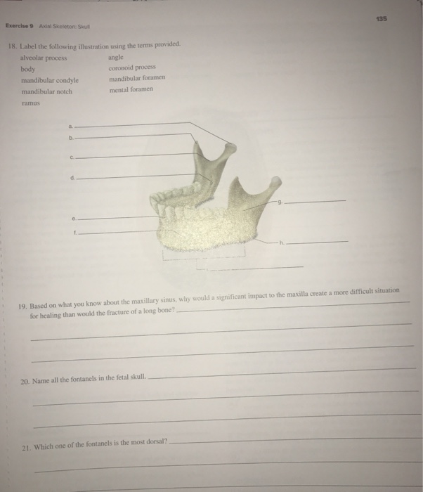 Solved 135 Exercise 9 Axial Skeleton Sku 18. Label the | Chegg.com
