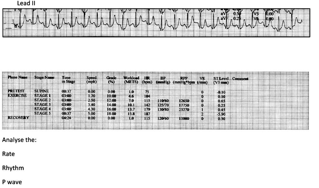 Solved Lead II Analyse the: Rate Rhythm P wave | Chegg.com