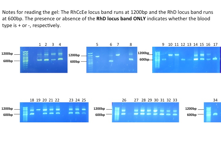 Solved Analyze the PCR product bands present in the DNA gels | Chegg.com