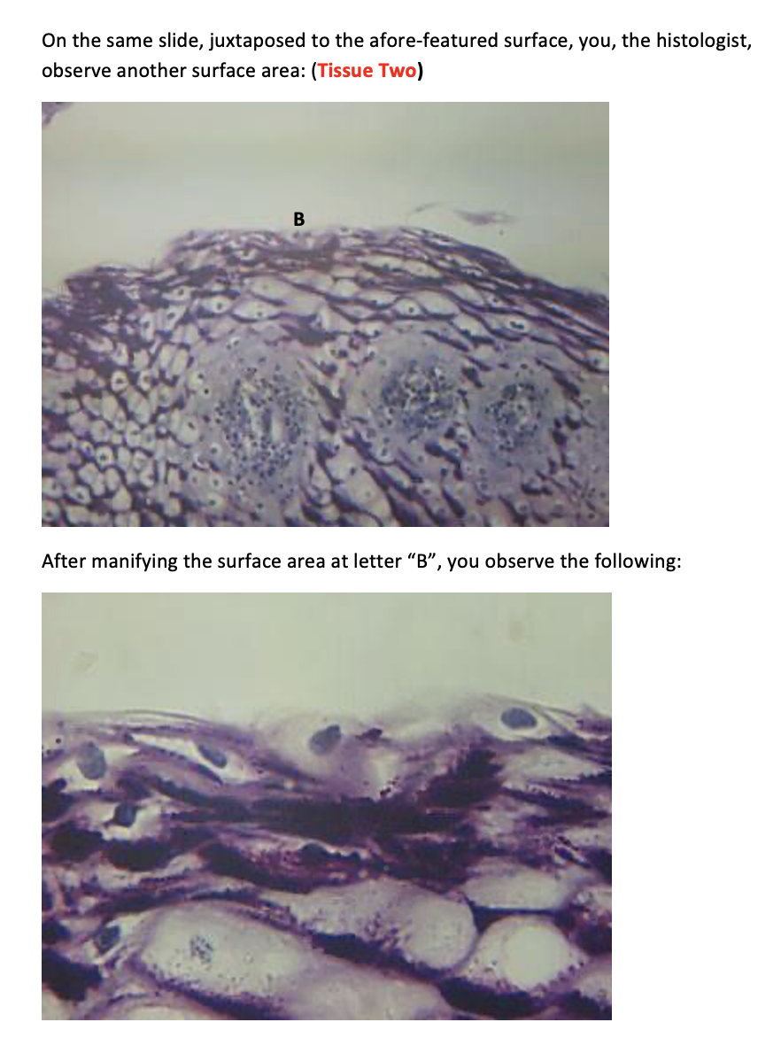 Solved Histology Assignment You, the histologist, observe a | Chegg.com
