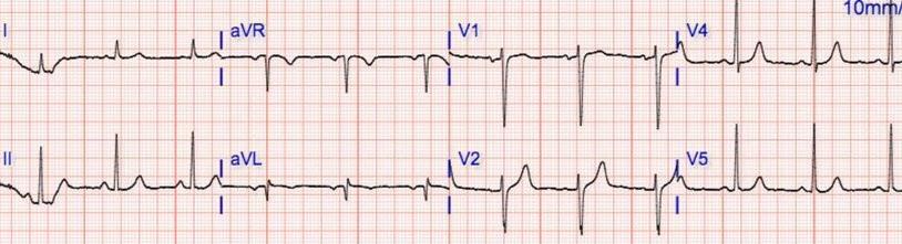 Solved Use 2 methods to estimate the heart rate. 1. sequence | Chegg.com