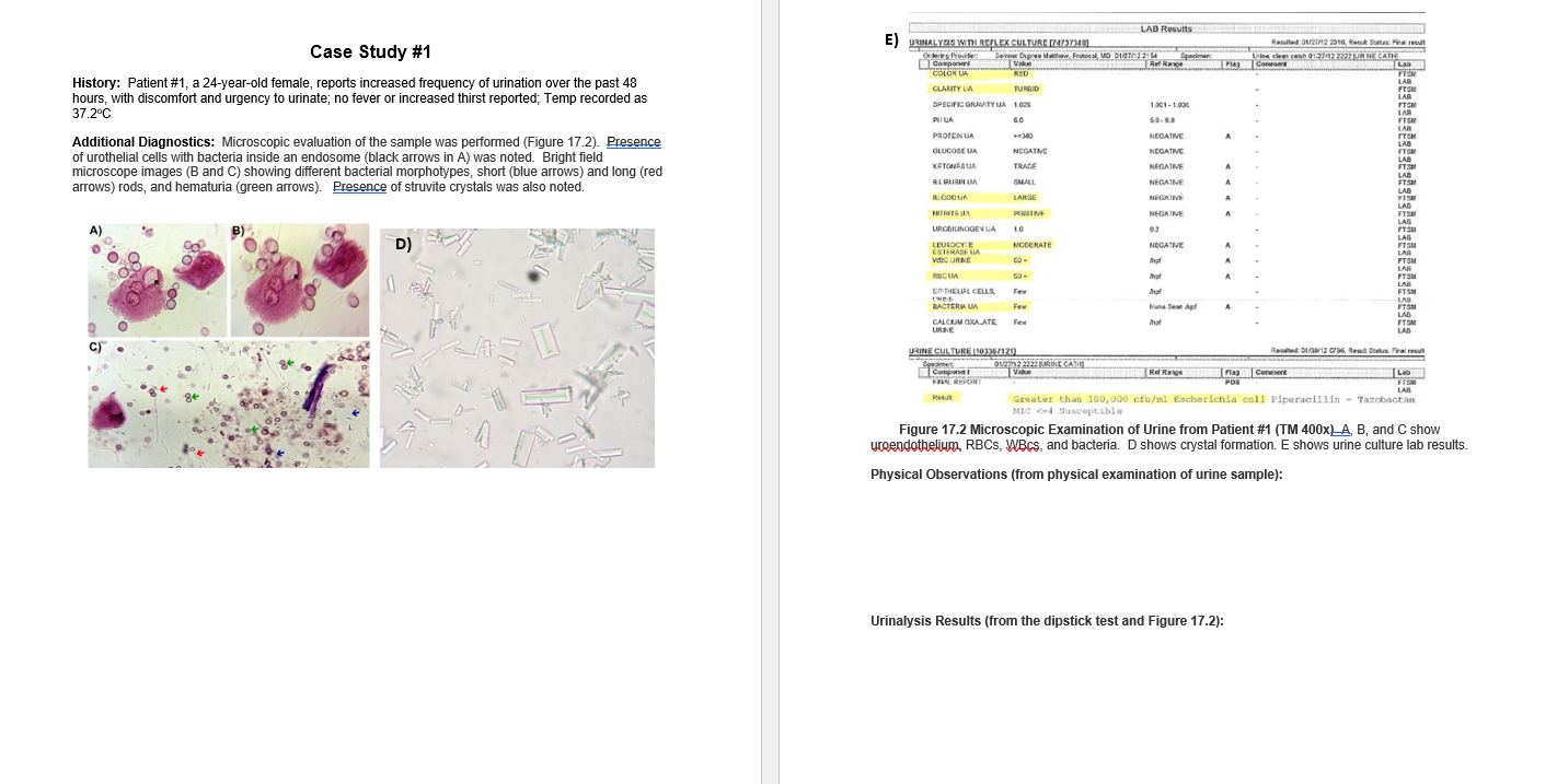 Solved For Patient#1, microscopic evaluation of the urine | Chegg.com