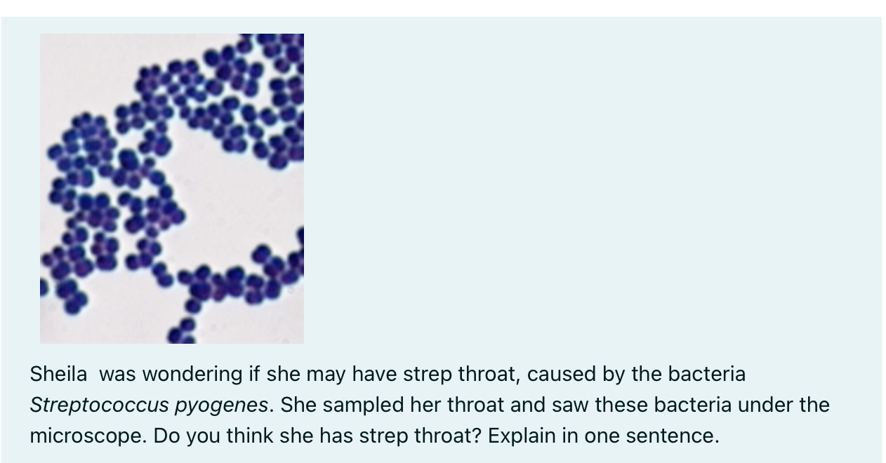 Streptococcus Bacteria Microscope