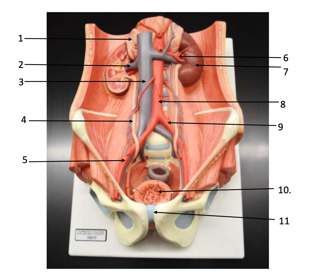 Solved Label the following structures: Abdominal | Chegg.com