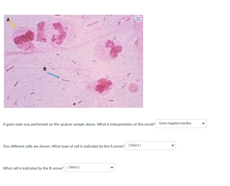 Solved A gram stain was performed on the sputum sample | Chegg.com