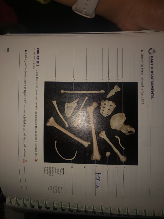 Solved PART D ASSESSMENTS 1. Identify the bones indicated in | Chegg.com