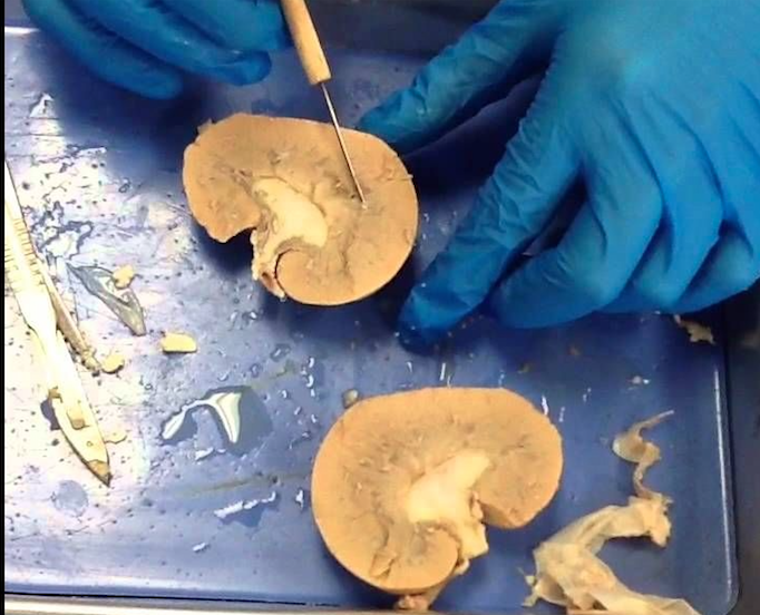 Solved Sheep Kidney dissection questions that I need | Chegg.com