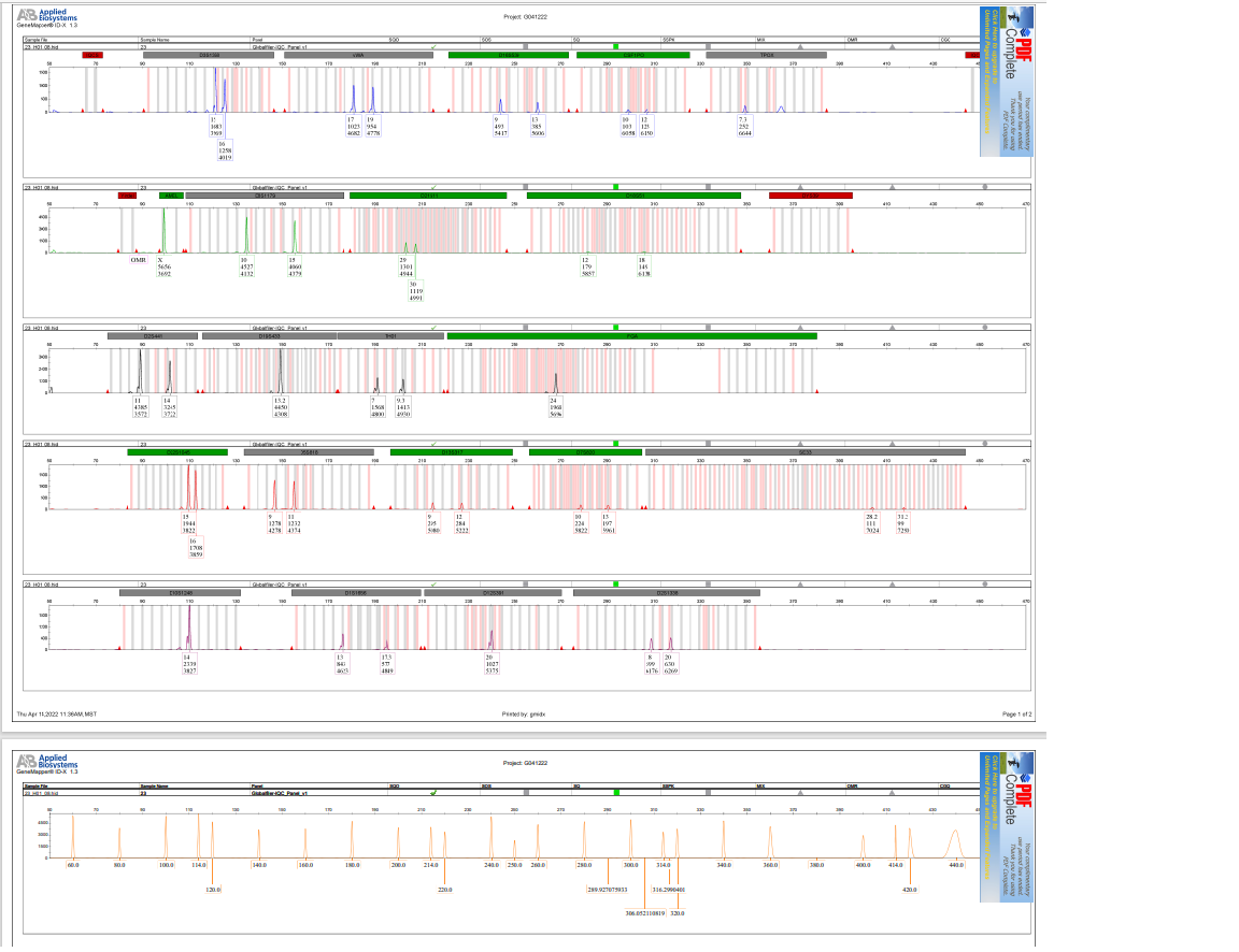 Examine each electropherogram for artifacts and | Chegg.com