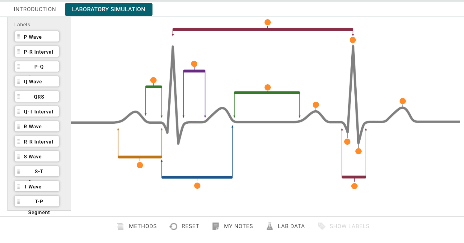 Solved INTRODUCTION LABORATORY SIMULATION Labels P Wave P-R | Chegg.com