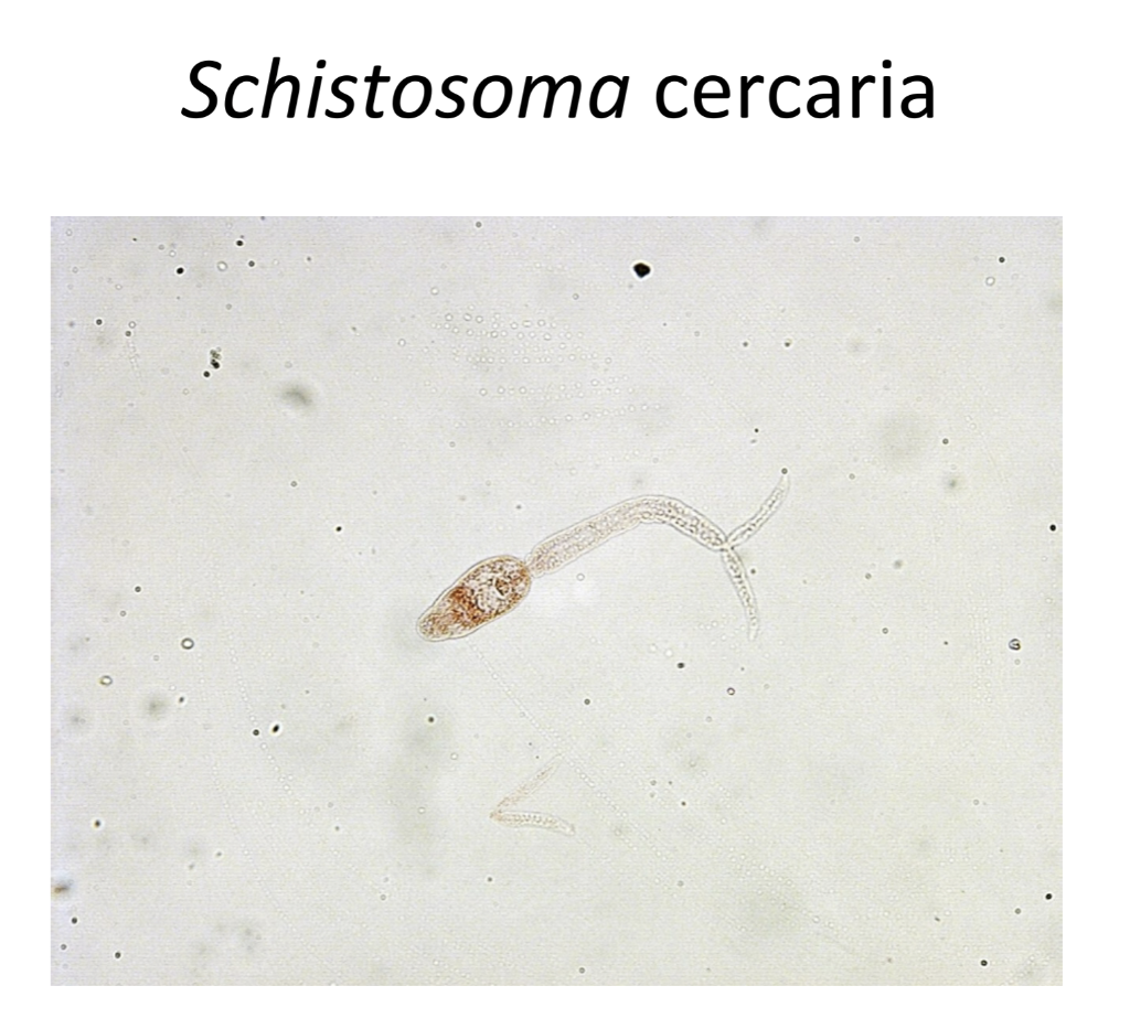 Solved Schistosoma cercaria | Chegg.com
