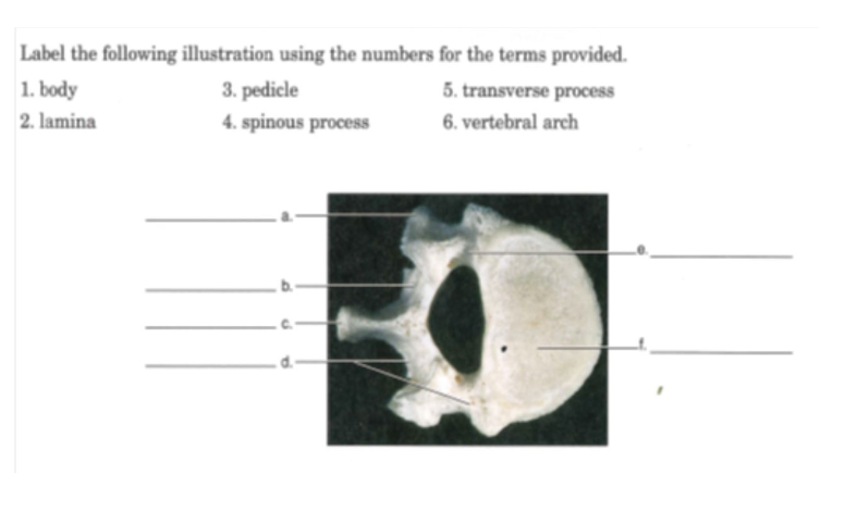 Solved Label the following illustration using the numbers | Chegg.com