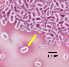 Solved The image (Figure 3) is a micrograph of | Chegg.com