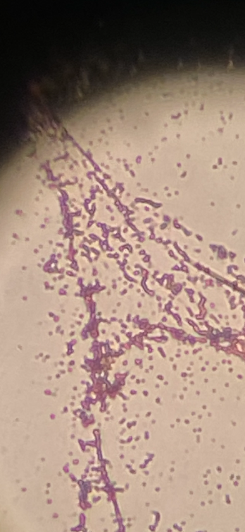Solved Identify this organism after a gram stain positive | Chegg.com