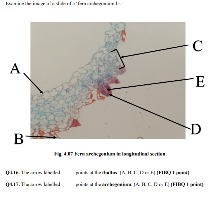 Solved Examine the image of a slide of a 'fern archegonium | Chegg.com