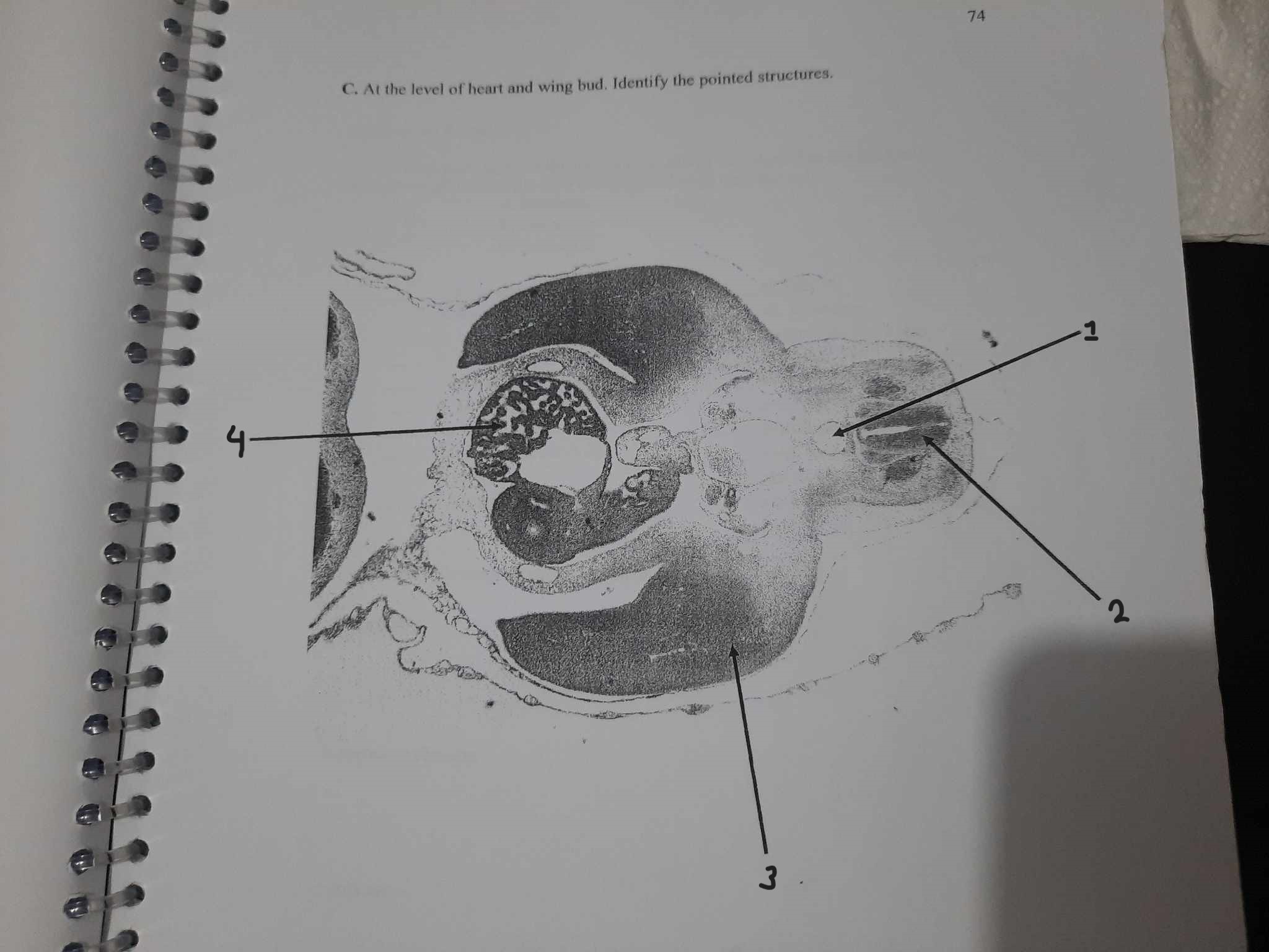 Solved At the level of heart and wing bud. Identify the | Chegg.com