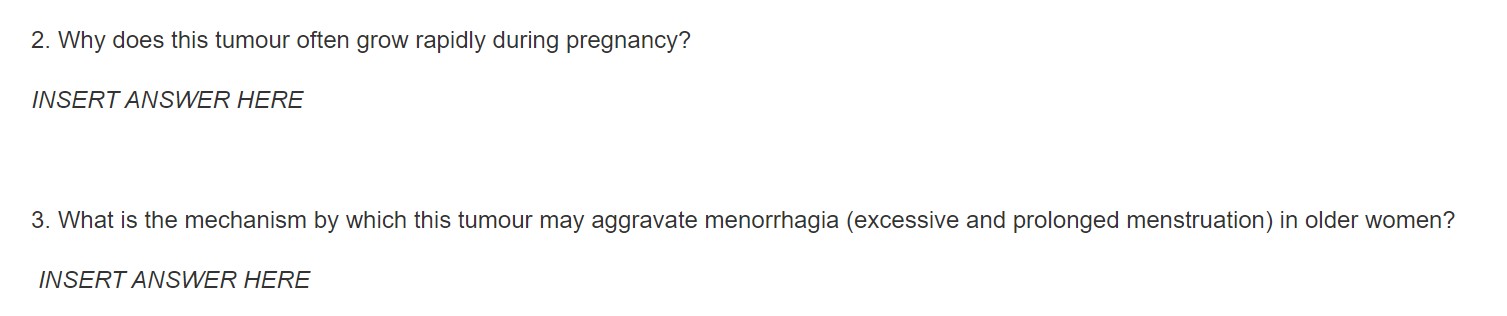 Solved STATION 1: Uterus-Leiomyoma (631.831.1) This tissue | Chegg.com