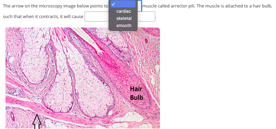 Solved muscle called arrector pili. The muscle is attached | Chegg.com