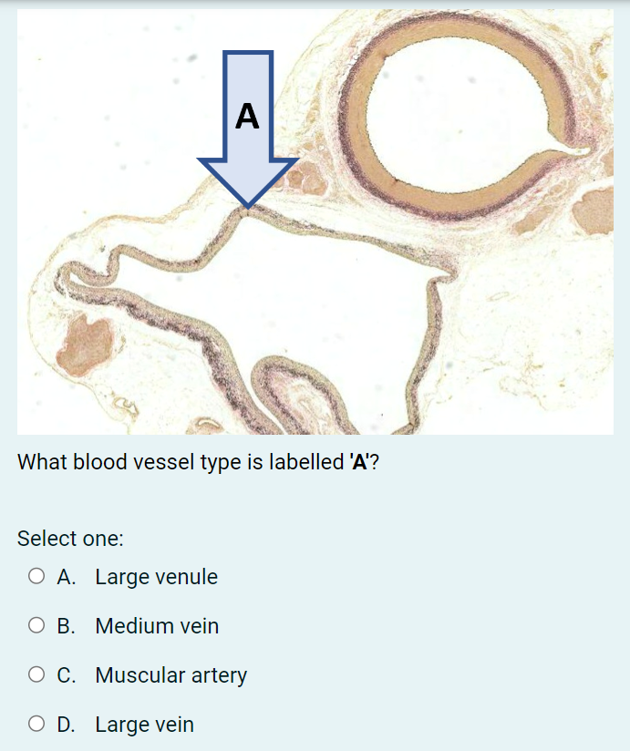Solved What blood vessel type is labelled 'A'? Select one: | Chegg.com
