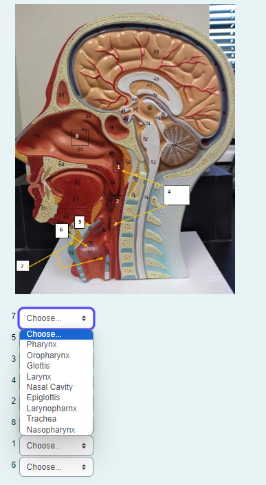 Solved Left Primary Bronchus Right Primary Bronchus | Chegg.com