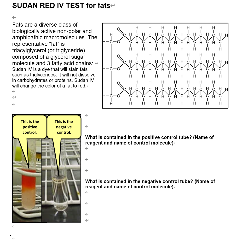 Solved SUDAN RED IV TEST for fats HIcIH H I-URI I-OI HlcIH | Chegg.com