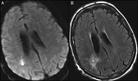 Solved Create a python code where you use OpenCV and | Chegg.com