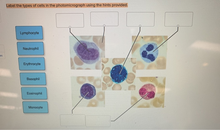 Solved Label the parts of the hemoglobin molecule. Globin | Chegg.com