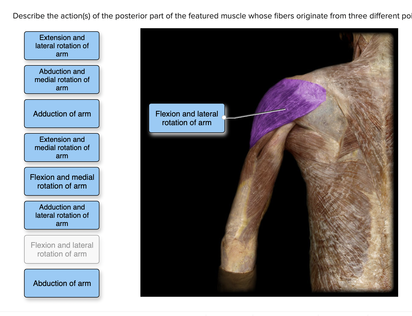 Solved Describe the action(s) of the posterior part of the | Chegg.com
