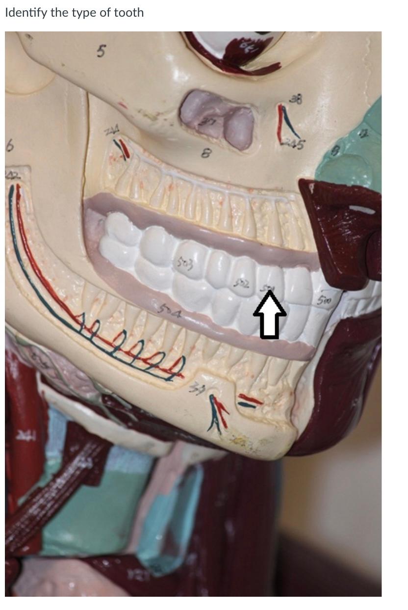Solved Identify the type of tooth 5 00 8 50 | Chegg.com