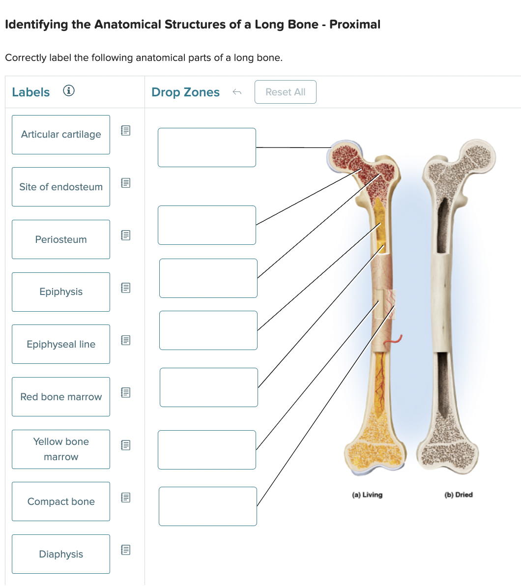 Solved Identifying the Anatomical Structures of a Long Bone | Chegg.com