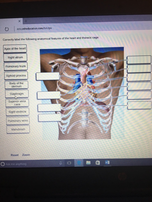 Solved: Correctly Label The Following Anatomical Features ... | Chegg.com