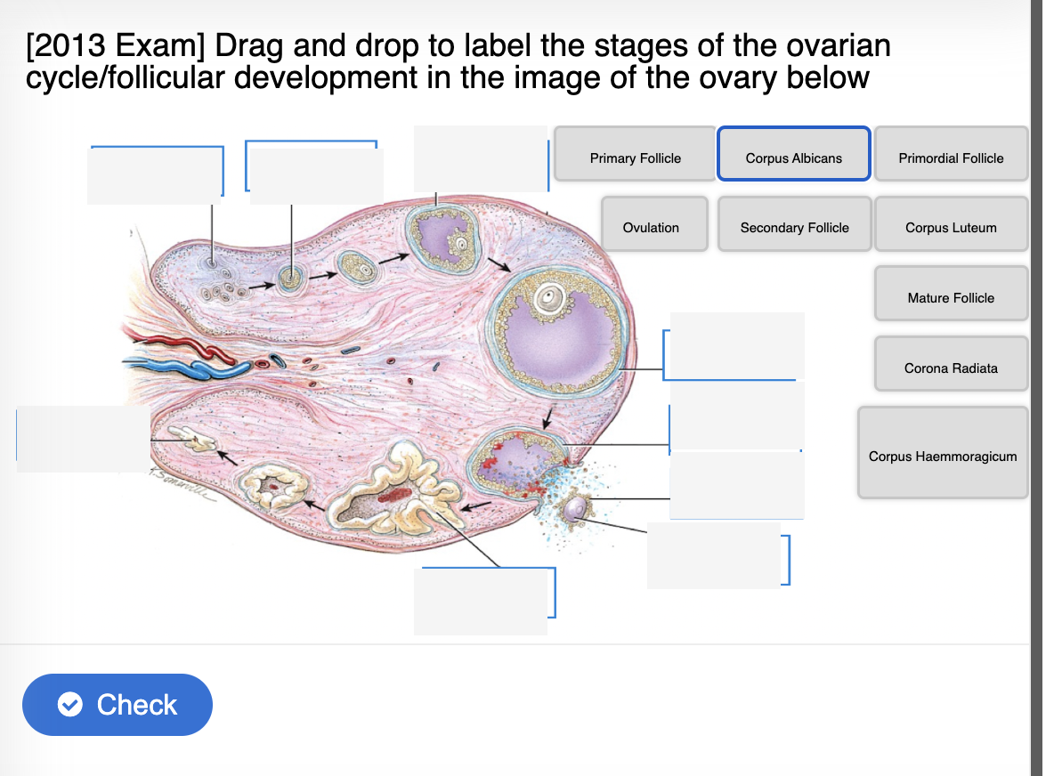 Solved [2013 Exam] Drag and drop to label the stages of the | Chegg.com