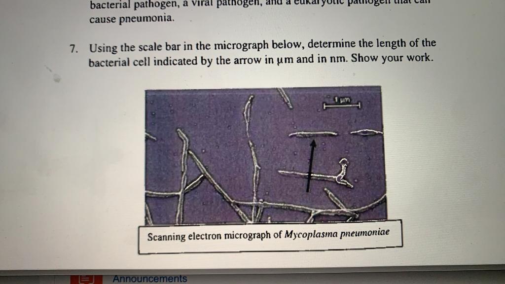 Solved Using the scale bar in the micrograph below, | Chegg.com