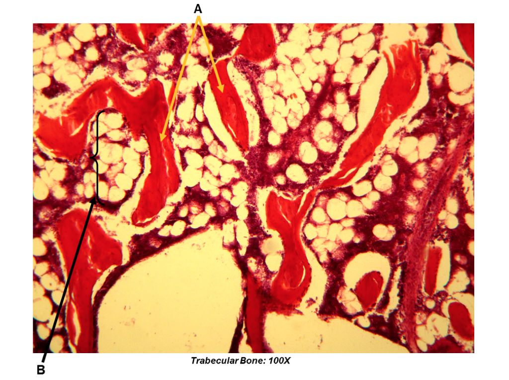 Solved Trabecular Bone: 100X | Chegg.com