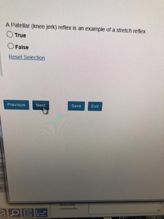 Solved A Patellar (knee jerk) reflex is an example of a | Chegg.com