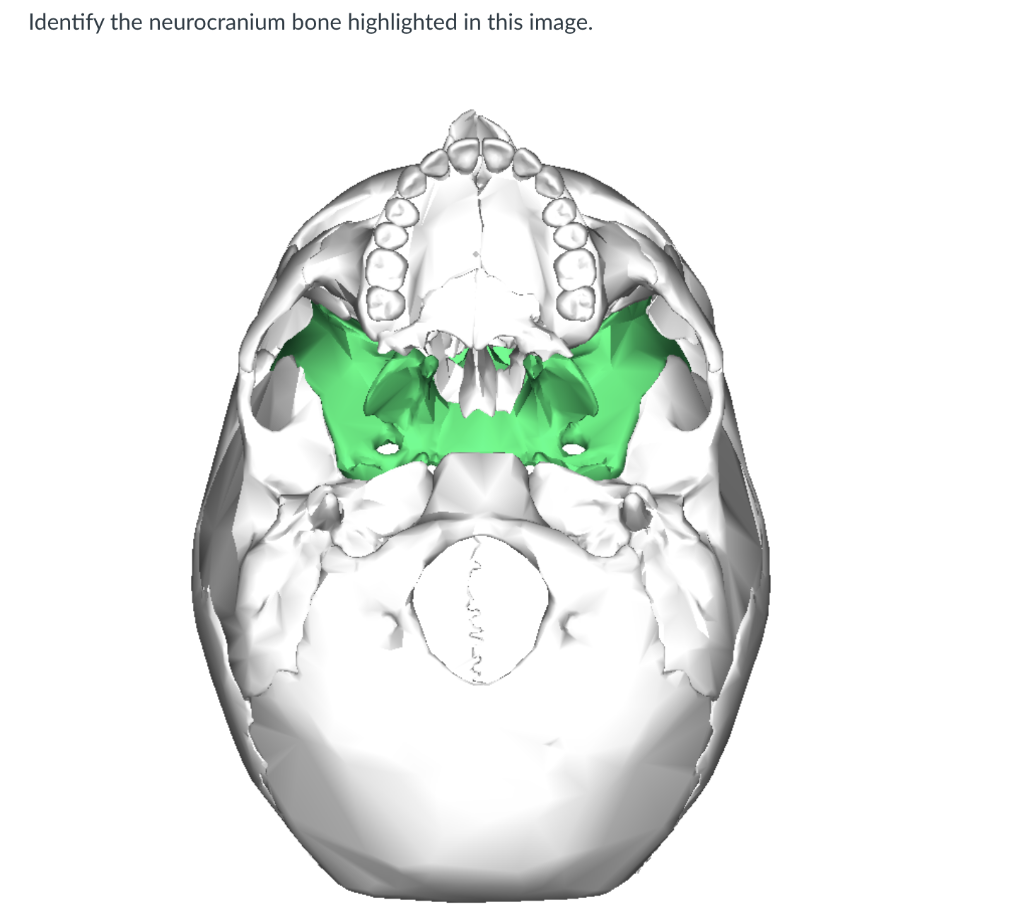 Solved Identify the neurocranium bone highlighted in this | Chegg.com