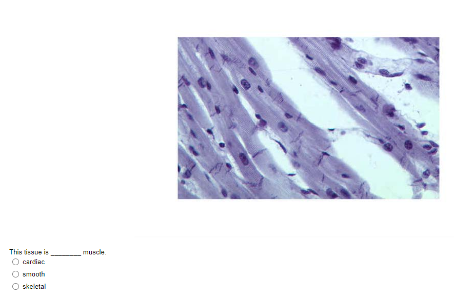 Solved muscle This tissue is O cardiac smooth skeletal | Chegg.com