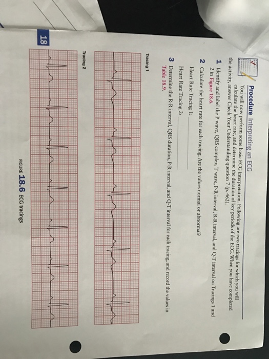 Solved You will now perform some basic ECG interpretation. | Chegg.com