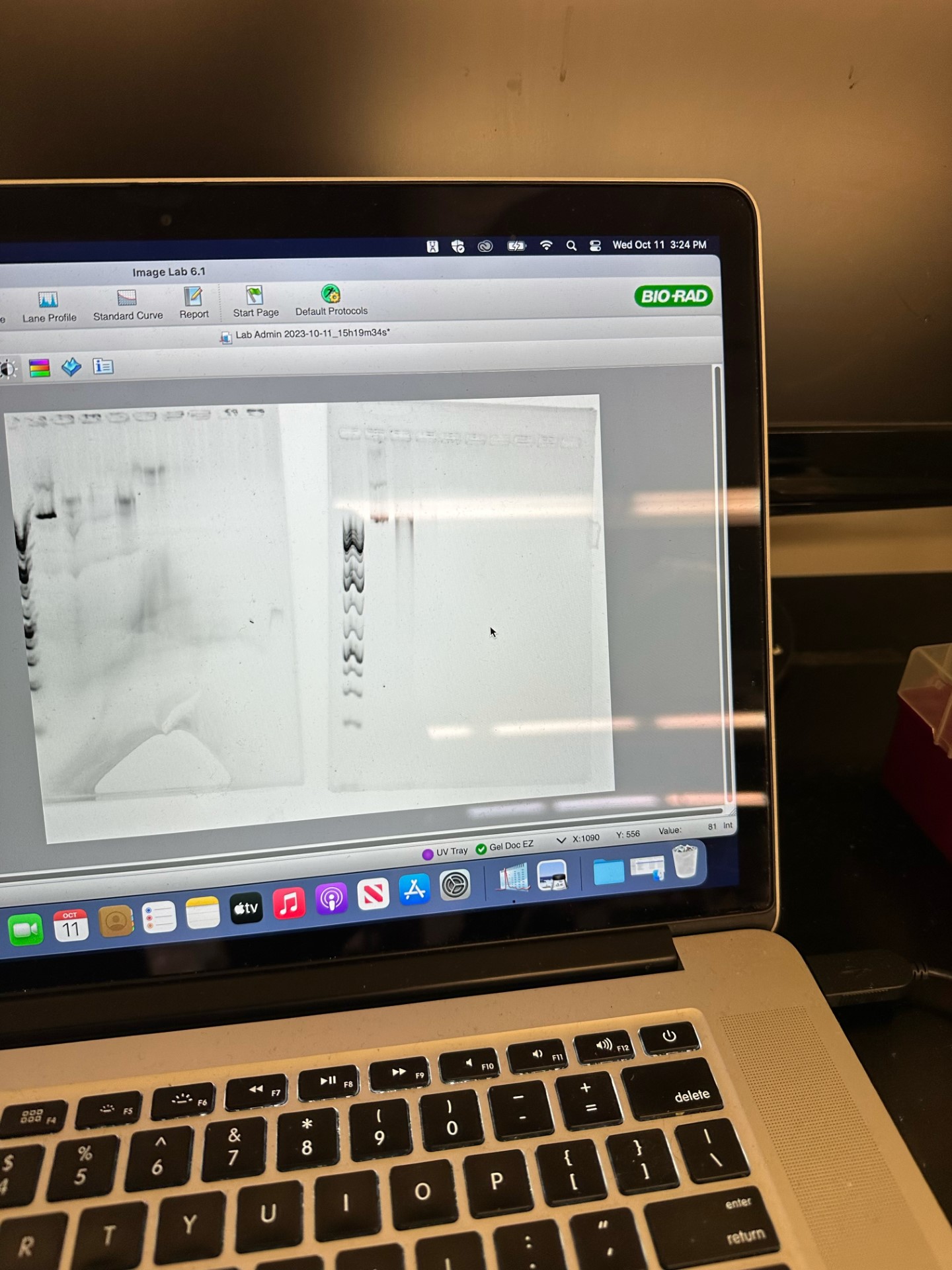 Solved Did you get any results for Exon 7 ﻿for your sample. | Chegg.com