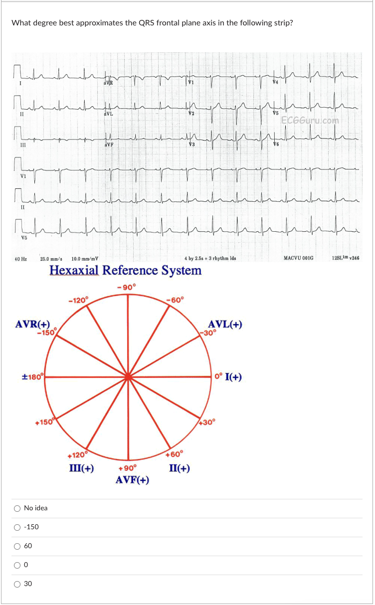 Solved What degree best approximates the QRS frontal plane | Chegg.com
